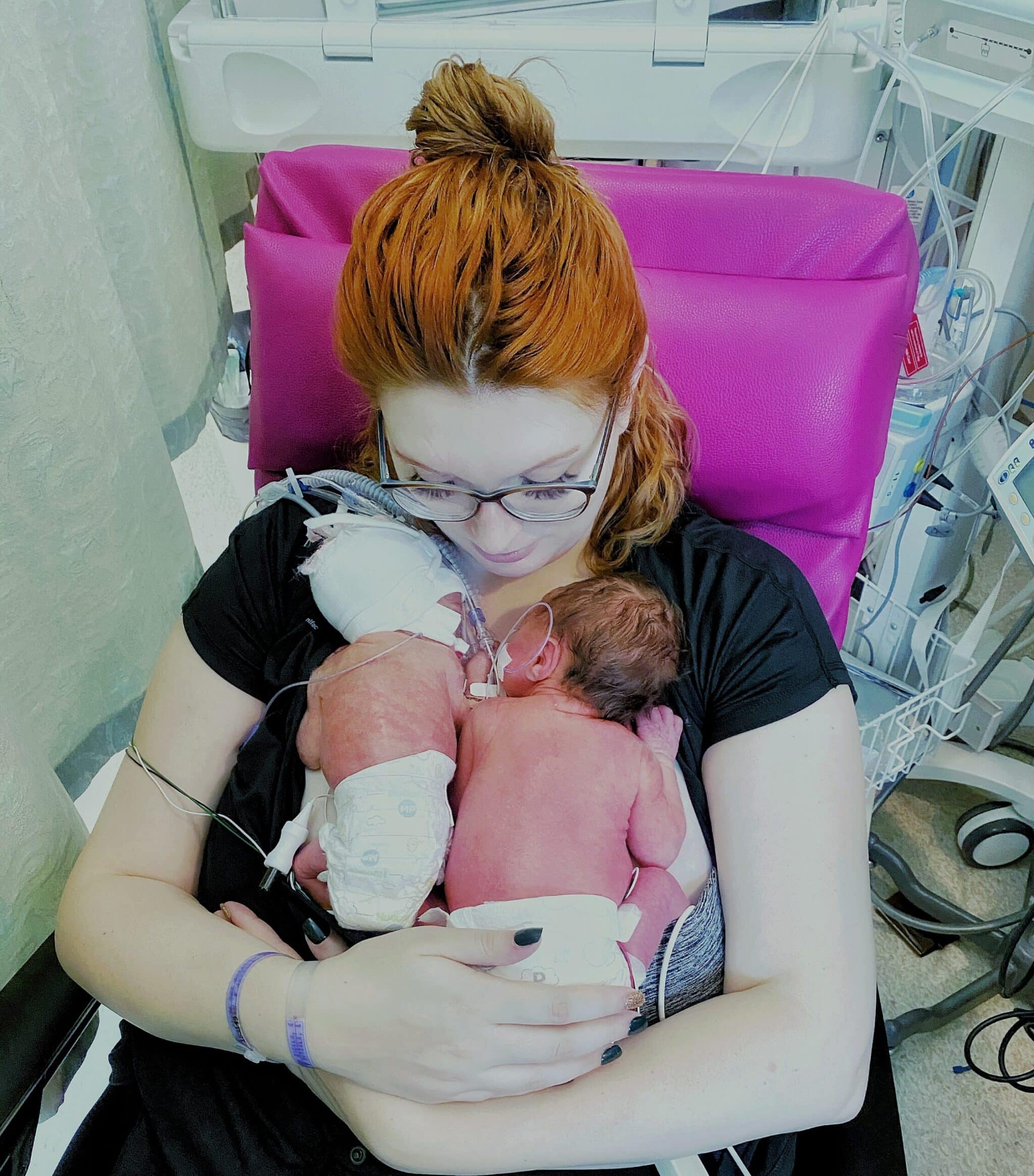 Newborn Feeding Tube: What to Expect and How to Deal | Twiniversity #1 ...